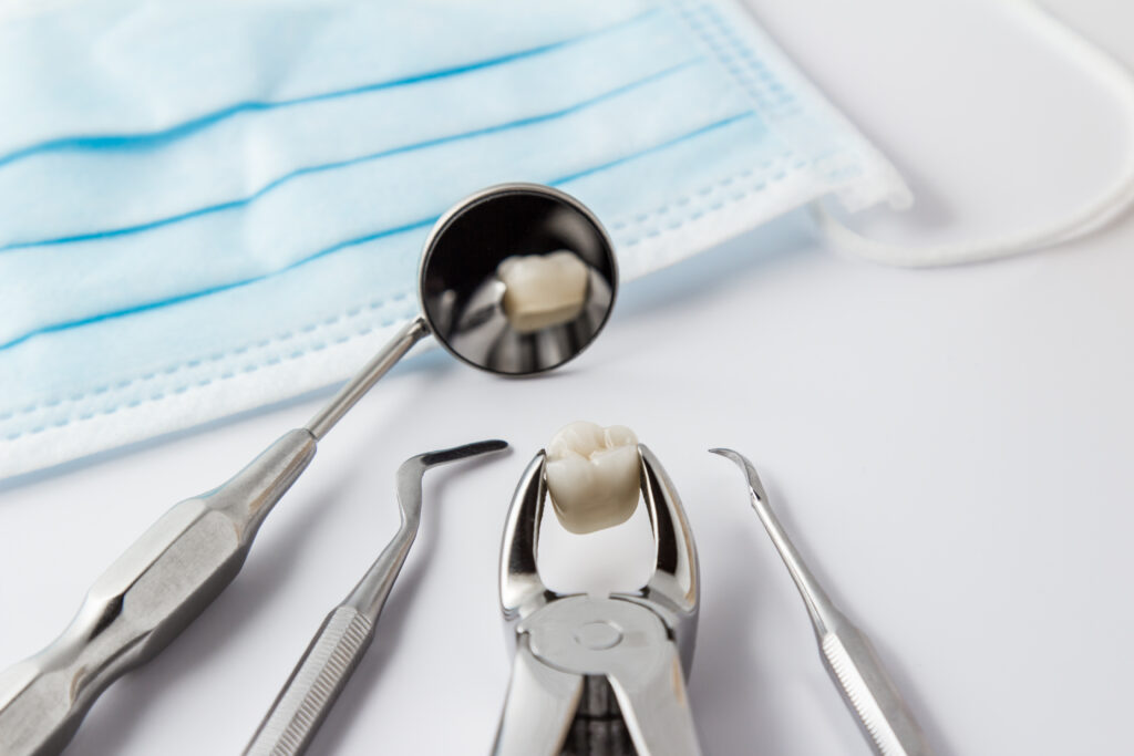 Non-impacted Wisdom Teeth Extraction | T-Town Smiles